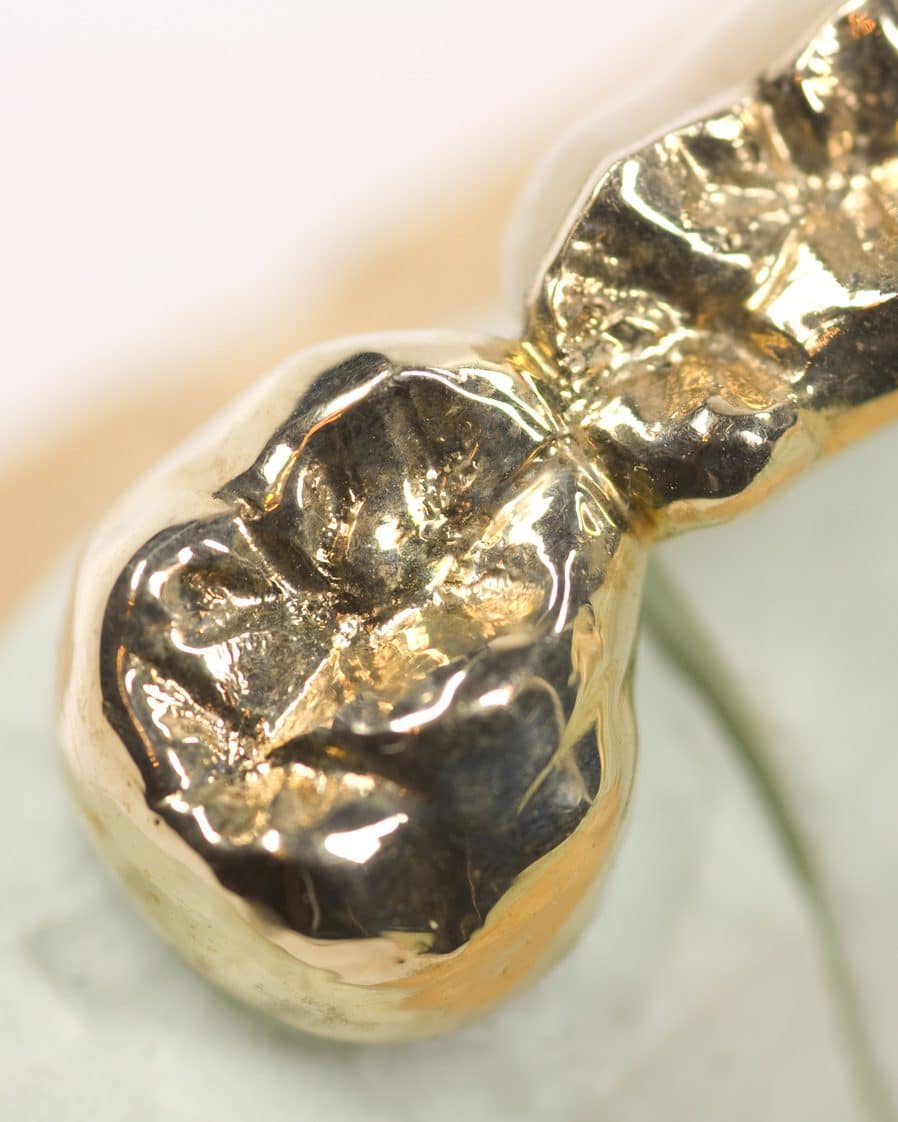 Zahngold Ankauf im Raum Stuttgart-Ludwigsburg | Goldankauf Martin